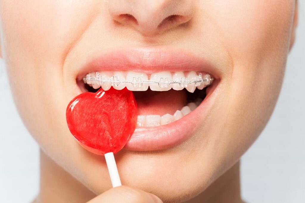 Eat the candy store