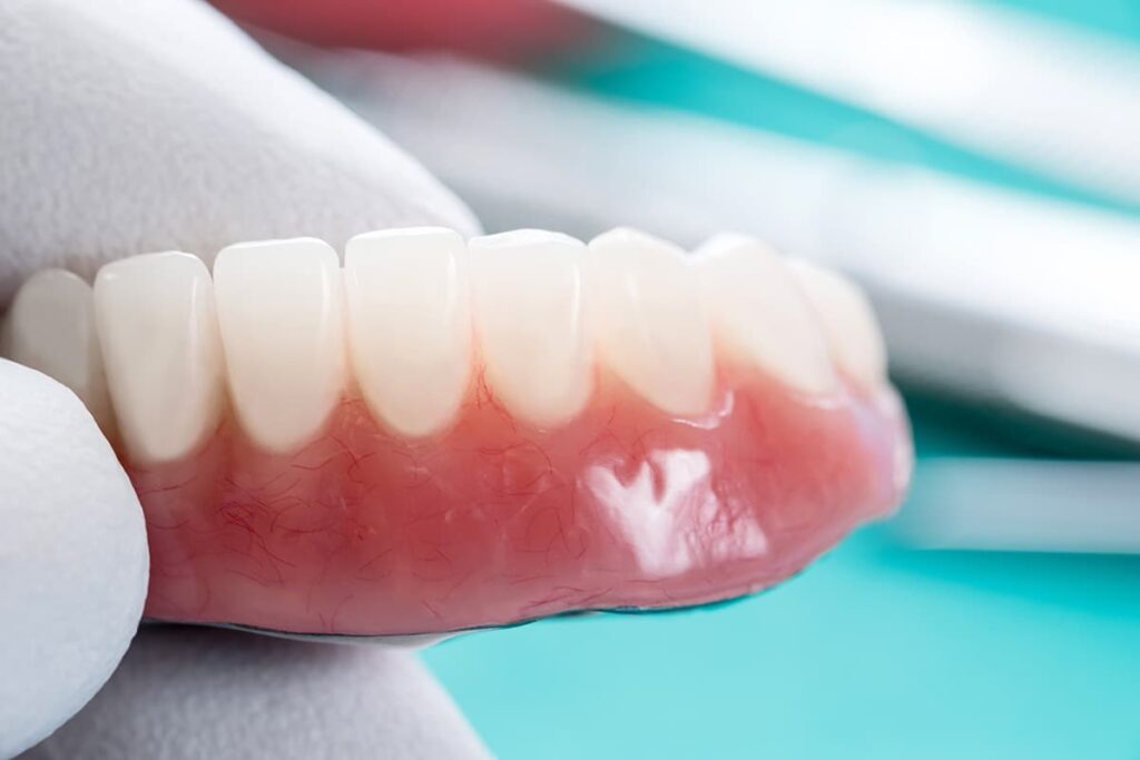 Hybrid Fixed Dentures | Specialty Dentistry | Lovett Dental TX